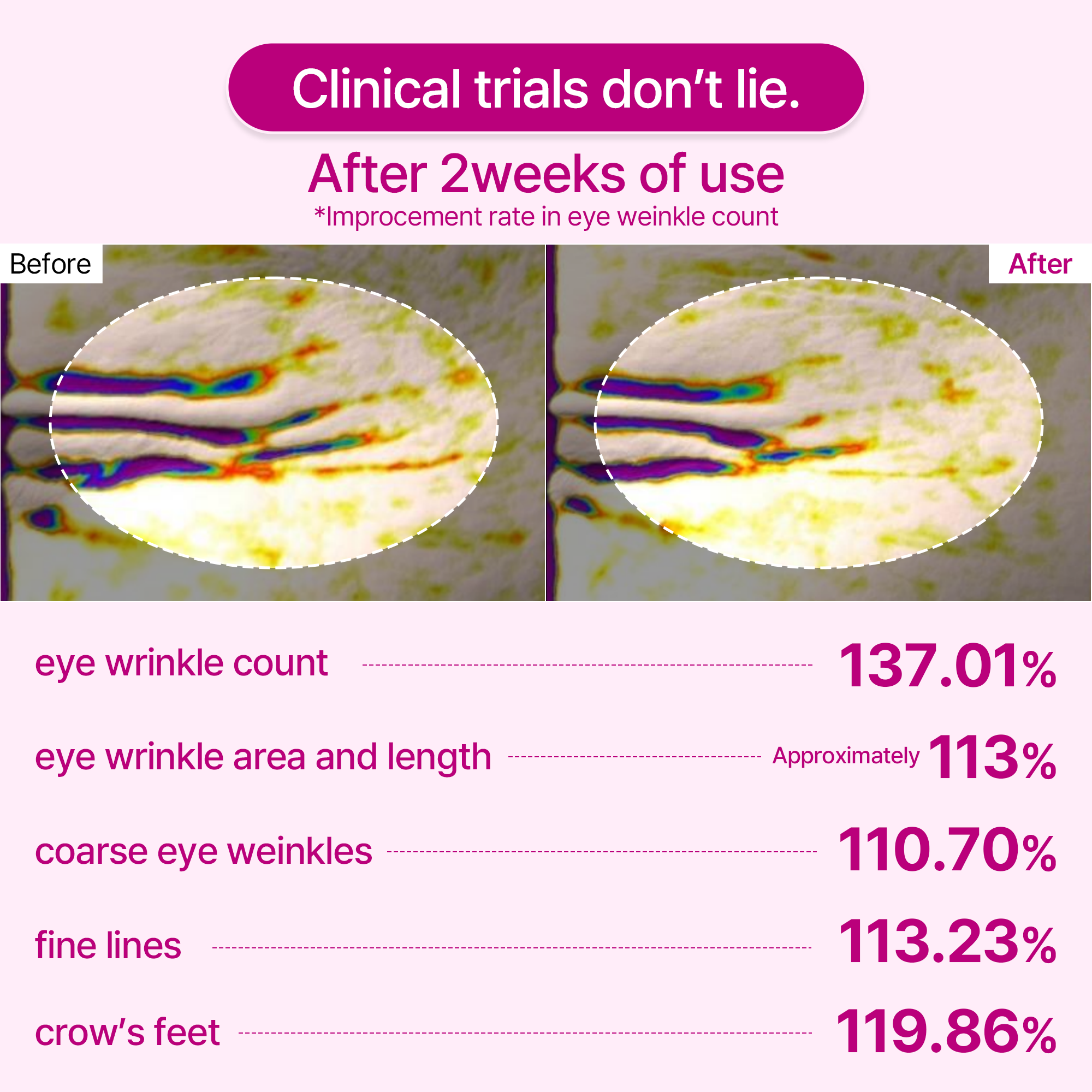 Cemenrete Calcium Volume Eye patch 60ea – Dr.Melaxin.us