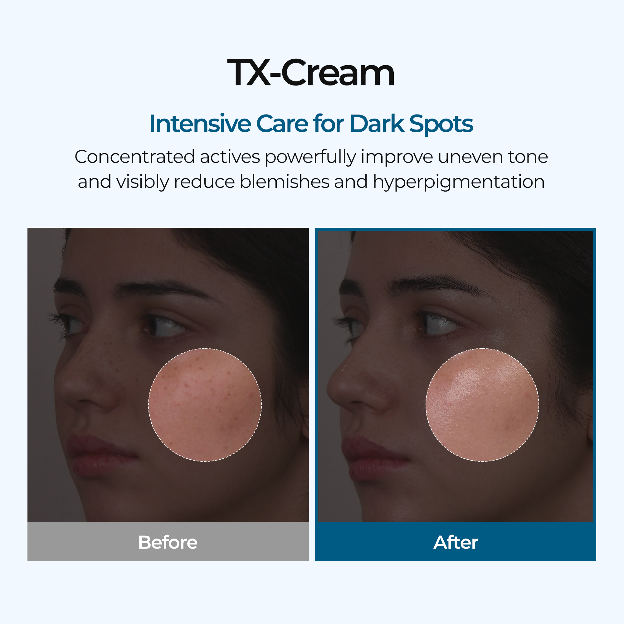 TX Cream – Dr.Melaxin.us