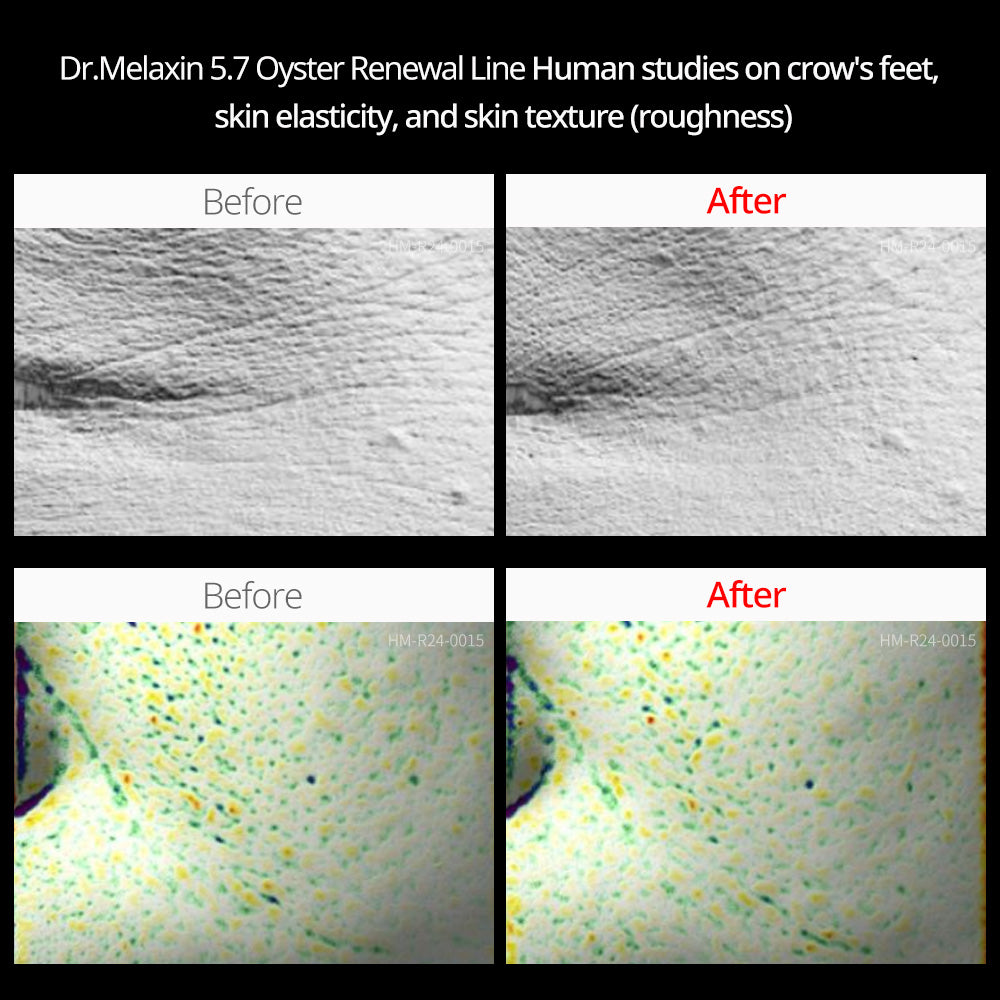 Oyster Pep-3 Renewal Anti-Aging Line – Dr.Melaxin.us