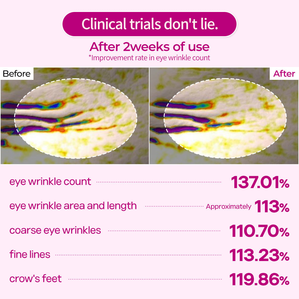 Cemenrete Calcium Volume Eye patch 60ea – Dr.Melaxin.us